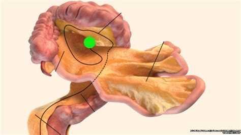 ¿qué Es El Mesenterio El Nuevo órgano Que Los Científicos Hallaron En El Cuerpo Humano Bbc