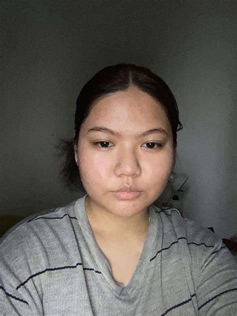9 Months On Tretinoin🙌🏻🙌🏻 Rtretinoin