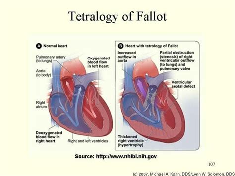 Pin On Respiratory Therapy