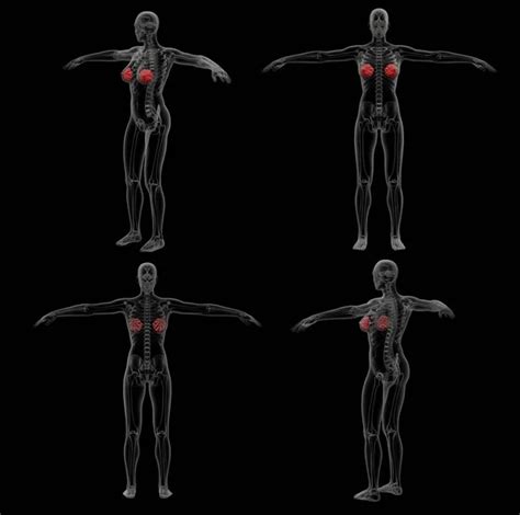 Body Trigger Points Stock Photos Royalty Free Body Trigger Points Images Depositphotos