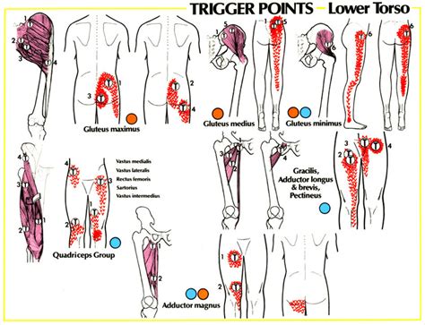 Sciatica Gadibody