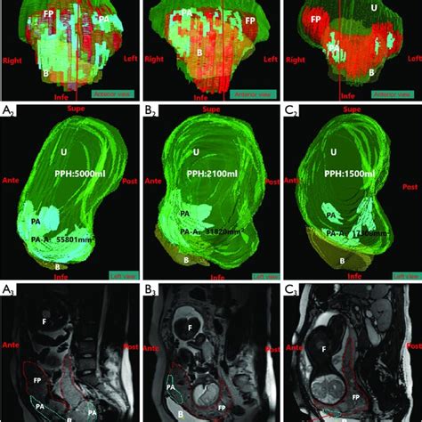 Three Dimensional Reconstructions Of Magnetic Resonance Imaging Of A Download Scientific