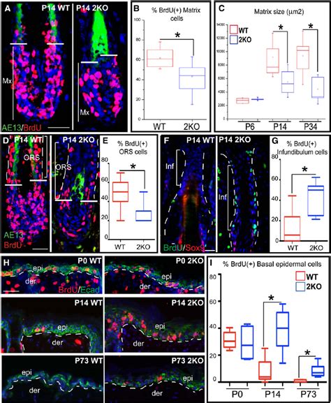 Loss Of Ezh1 2 Results In Reduced Proliferation Of Hf Ors And Matrix Download Scientific