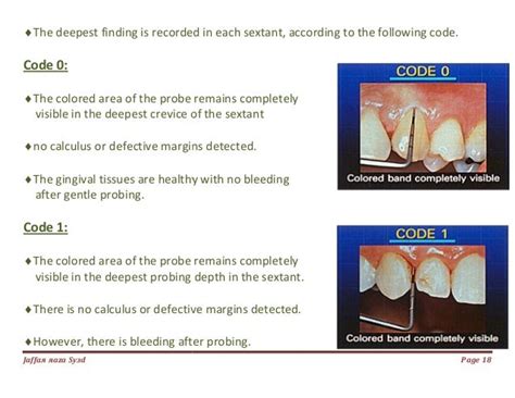 029periodontal Diagnosis And Prognosis