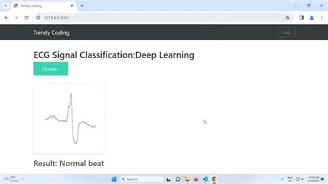 Nagarajan N On Linkedin Deep Learning Project Ecg Signal Classification