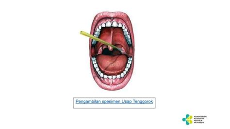 Tata Cara Penanganan Monkeypox Mmmmmmmmmm Ppt