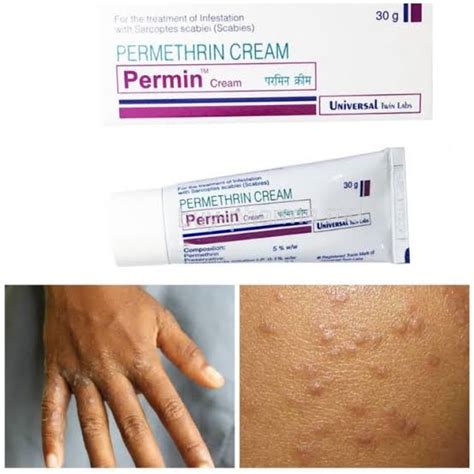 Permethrin Cream Famedix Pharmacy