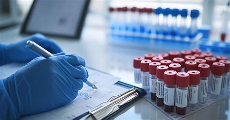 Anmat Aprobó Un Tratamiento Innovador Para El Mieloma Múltiple Cómo Actúa Y Para Qué Pacientes