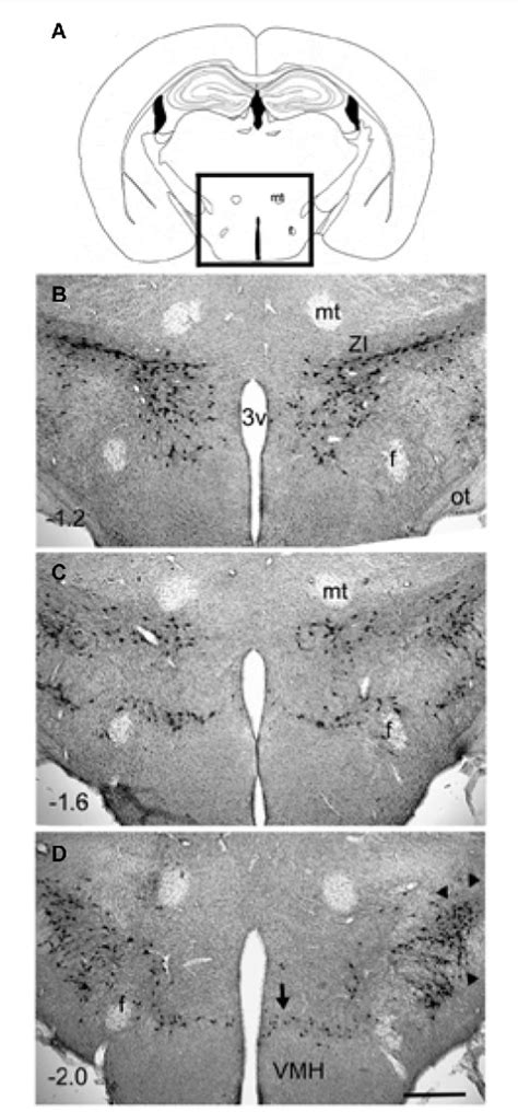 Figure 1 From Neurons Containing Orexin Or Melanin Concentrating Hormone Reciprocally Regulate