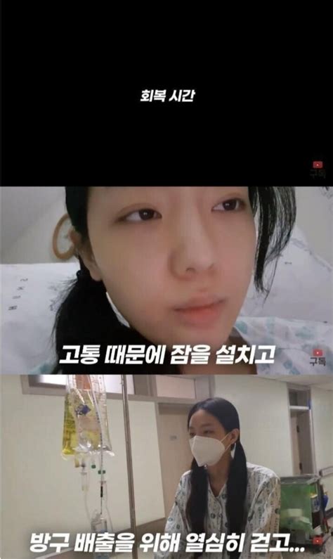 천운으로 췌장암 발견한 유튜버  Mlbpark