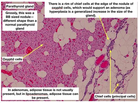 Parathyroid Histology Chief Cells