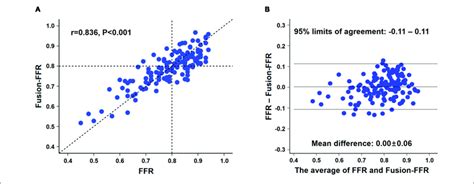 Relationship Between Pressure Wire Based Ffr And Fusion Ffr
