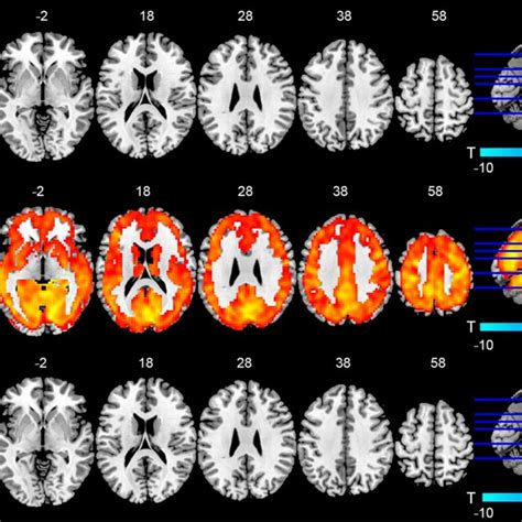 Sex Difference T Value Of The Two Sample T Test Of A Ben B Cbf And Download Scientific