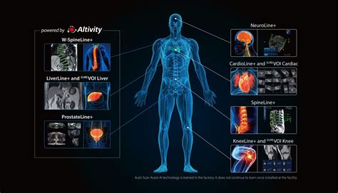 Ai Automated Mri Planning Solution Launched To Beat Waiting List Backlogs And Support Efficient Uk