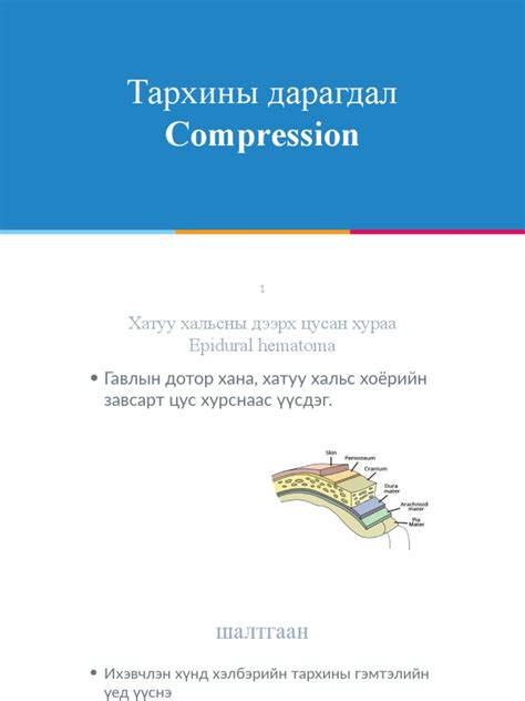Subdural Pdf