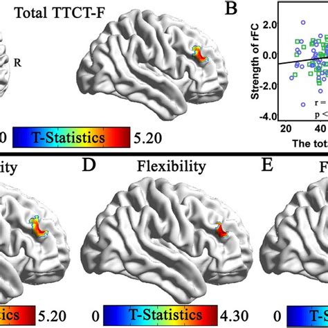A Region Of Correlation Between The Strength Of Rsfc With The Right