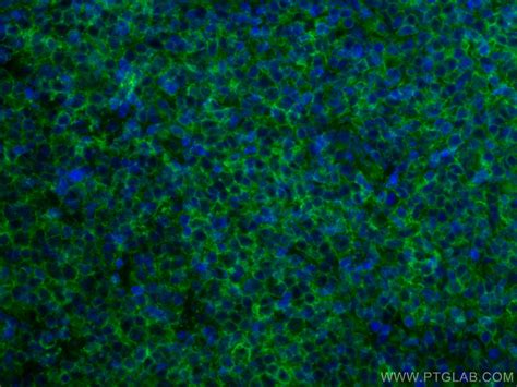 Hla Class I Abc Antibody Cl488 66013 Proteintech