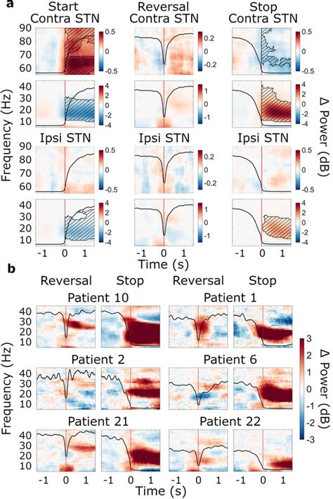 Context Dependent Modulations Of Subthalamo Cortical Synchronization During Rapid Reversals Of