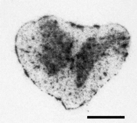 First Discrete Autoradiographic Distribution Of Aminopeptidase N In