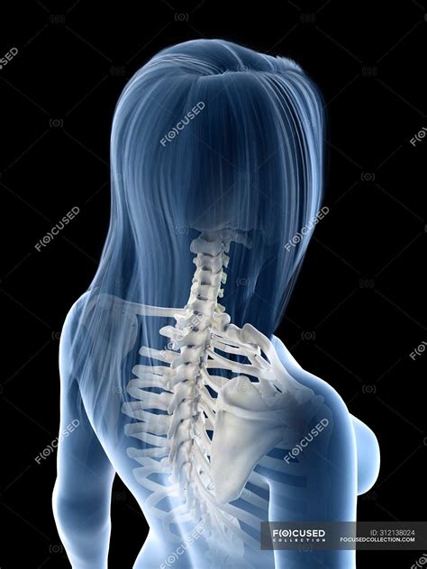 Female Anatomy Showing Cervical Spine Computer Illustration Backbone Medicine Stock Photo