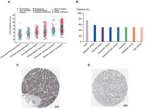Sstr2 Targeted Theranostics In Hepatocellular Carcinoma