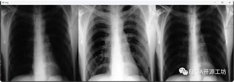 FPGA实现CLAHE算法 Verilog 知乎