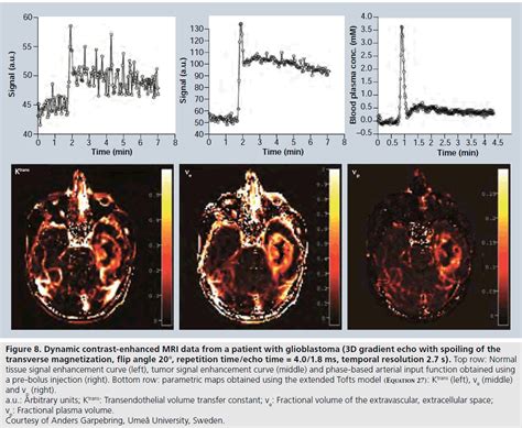 Using Contrast Agents To Obtain Maps Of Regional Perfusion And Ca