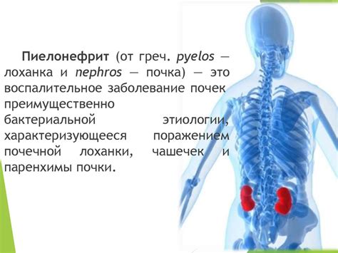 Острый и хронический пиелонефрит - online presentation