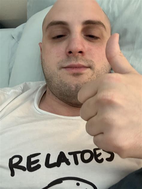 before after my first hair system r hairsystem