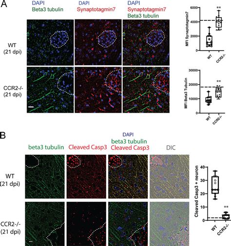 Ccr2 Pathway Promotes Regional Defects In The Production Of Download Scientific Diagram