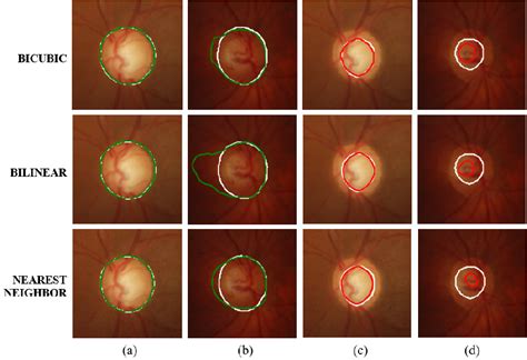 optic disc and optic cup segmentation results by different