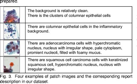 Figure 3 From Automated Report Generation For Lung Cytological Images Using A Cnn Vision