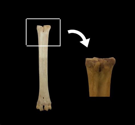 Metacarpal Proximal Morphology A The Lateral Epicondyle Is Confined Download Scientific