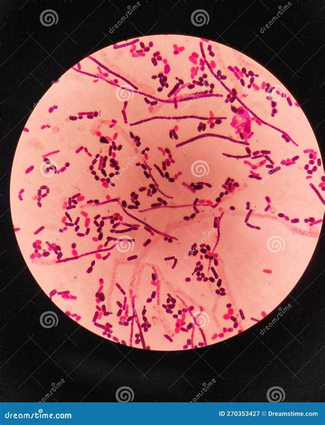 Yeast Cells And Hyphae In Gram Stain Fine With Microscope Stock Image