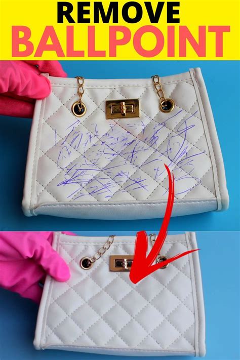 How To Remove Ballpoint Ink In White Shirt Free Word Template