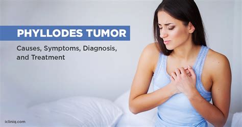 What Is A Phyllodes Tumor