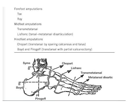 Lower Limb Prosthesis Pptx