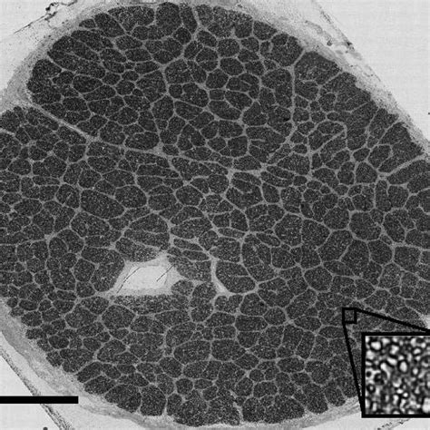 Microscope Image Of Full Optic Nerve Cross Section Used For