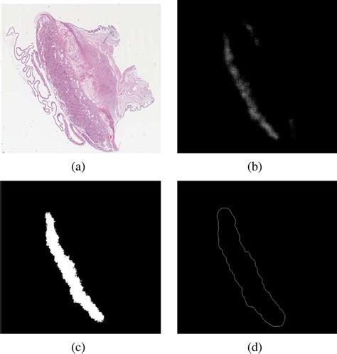 A A Slice Of The 04 2069 Placenta B Segmentation Probability Map