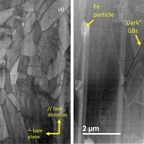 A Bright Field Scanning Transmission Electron Microscopy Stem Image Download Scientific