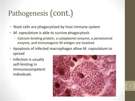 Ppt Histoplasma Capsulatum And Histoplasmosis Powerpoint Presentation Id 2001078