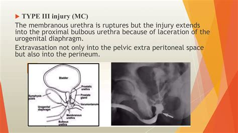 Rgu And Mcu Procedure And Interpretation In Commonly Encountered Disease Conditions Pptx