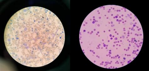 【眼科医院健康科普】血液里的 隐形卫士”：网织红细胞学术园地北京市中医药管理局