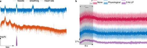 Spectral Analysis And Time Domain Output Signals With Different Filters