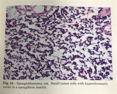 International Histological Classification V