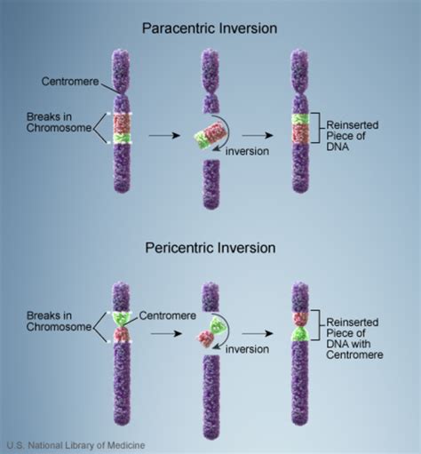 Recombinant Syndrome MedlinePlus Genetics