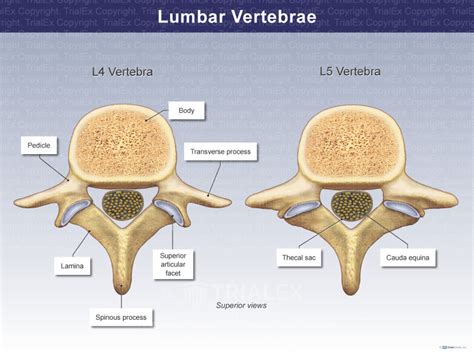Lumbar Vertebrae Trialquest Inc