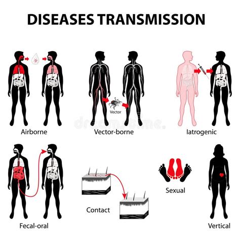 Disease Transmission Stock Vector Illustration Of Direct 66965266