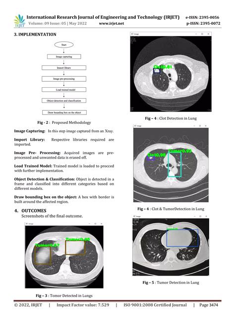 Lung Cancer Detection Using Convolutional Neural Network Pdf