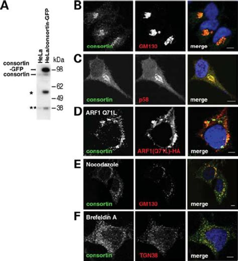 Subcellular Localization Of Consortin In The Golgi Apparatus A Download Scientific Diagram